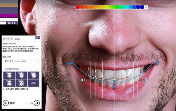 DSD數位微笑設計｜顏面美學設計 美齒貼片 ｜丰采美學牙醫診所