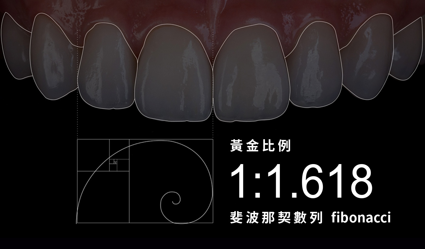 顯微瓷牙貼片 高仿真極致美學・數位微笑設計｜丰采美學牙醫診所